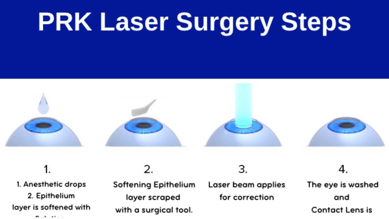 Glaucoma Cost Comparison: Laser, Drops, and Surgery in the U.S.